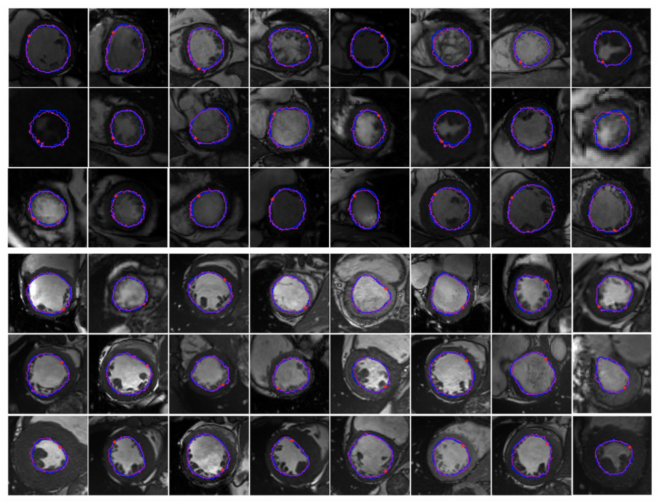 Edge-Sensitive Left Ventricle Segmentation Using Deep Reinforcement Learning