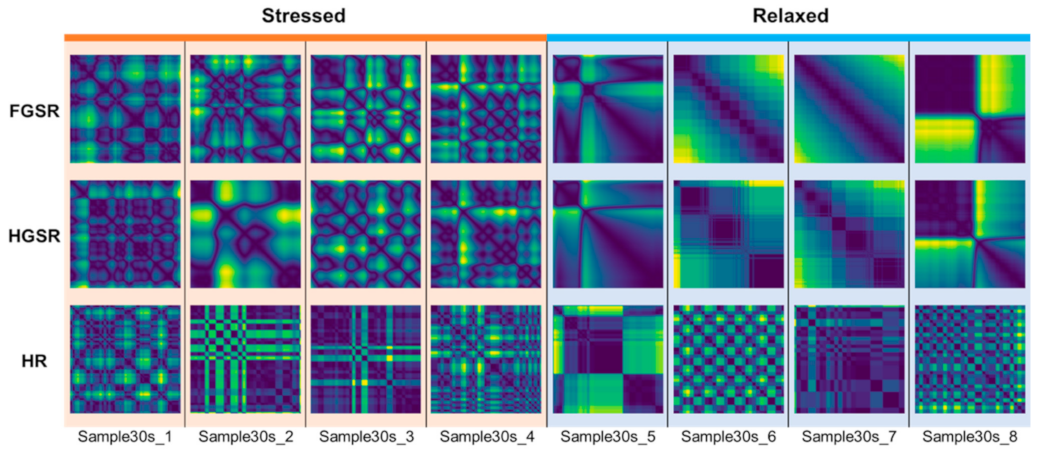 Driving Stress Detection Using Multimodal Convolutional Neural Networks with Nonlinear ...