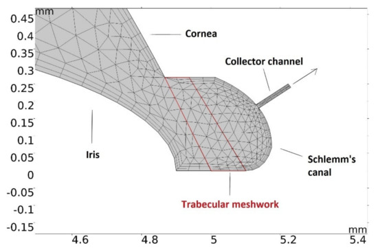 Sensors | Free Full-Text | Phacoemulsification and IOL-Implantation ...