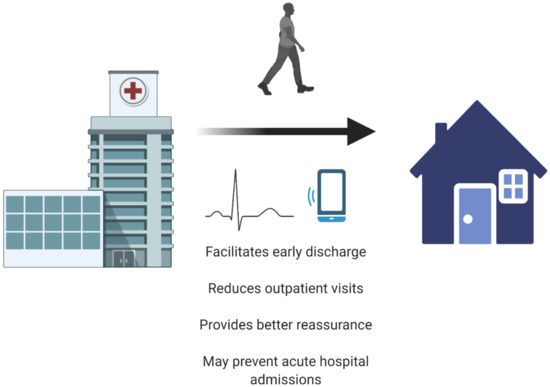 Sensors | Free Full-Text | Smart Wearables for Cardiac Monitoring—Real ...