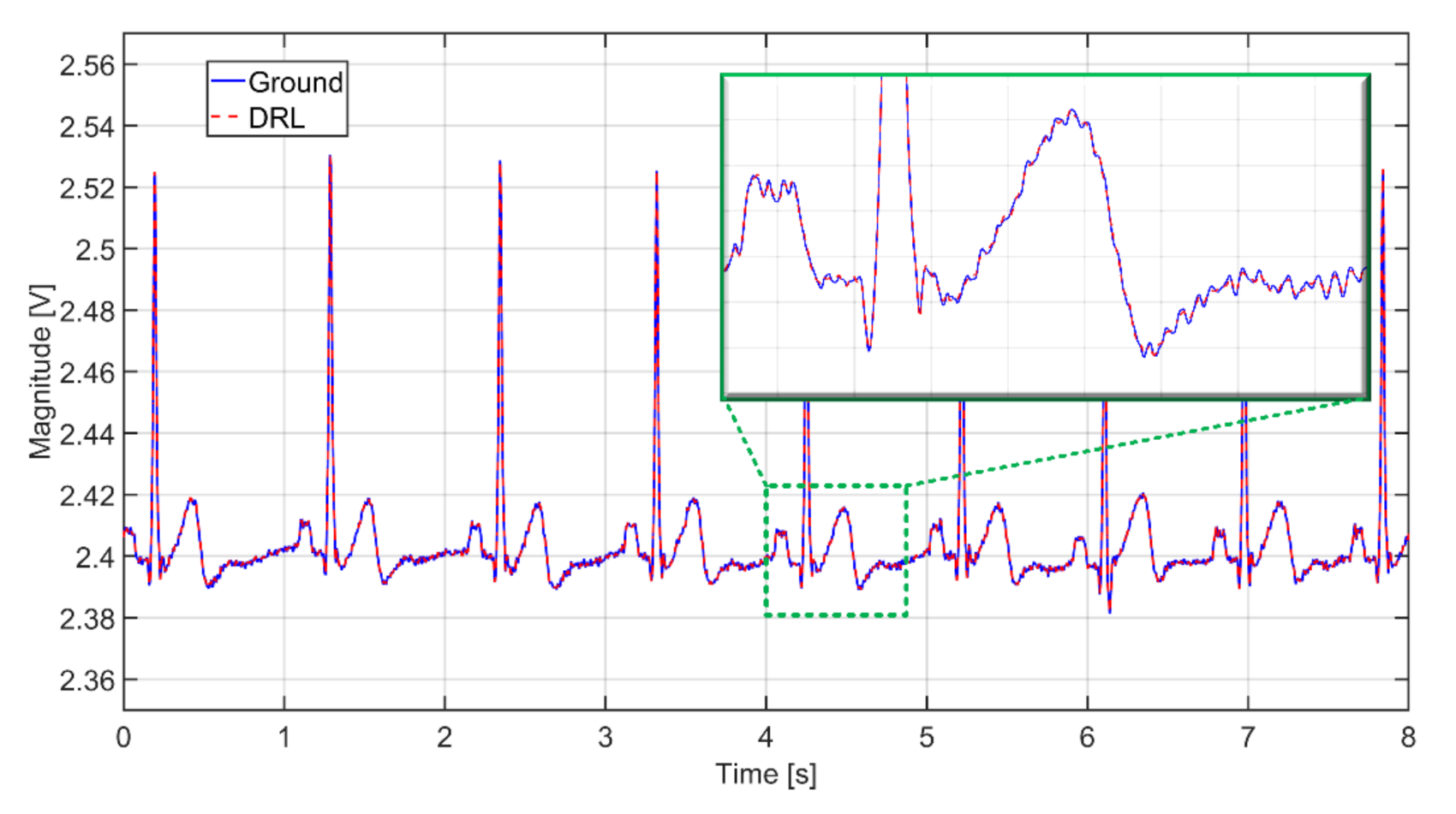 Sensors Free Full Text Common Mode Voltage Reduction In Capacitive