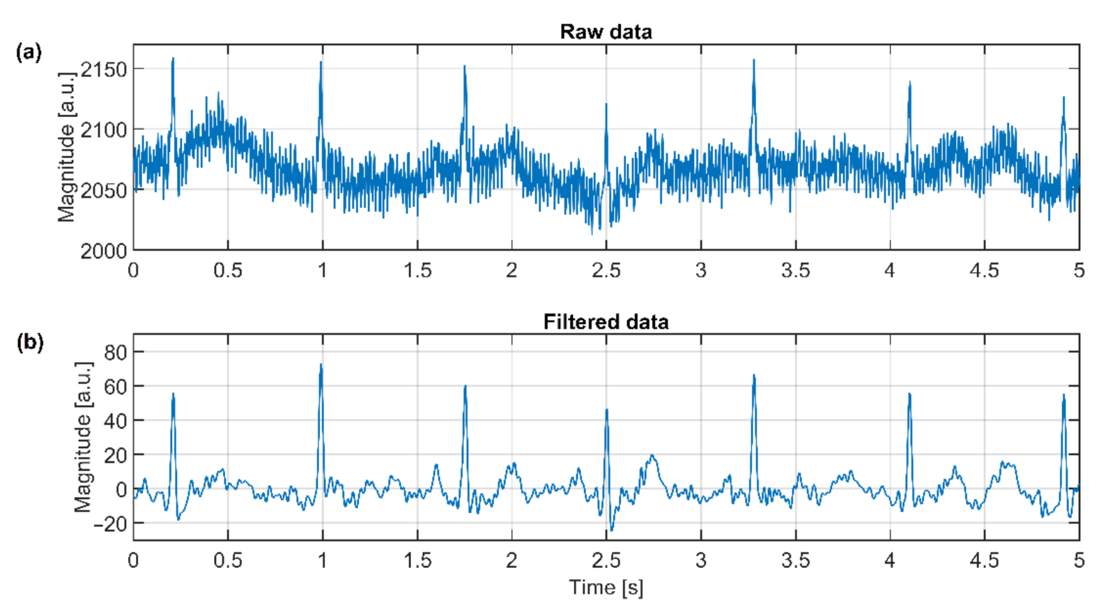 Sensors Free Full Text Common Mode Voltage Reduction In Capacitive