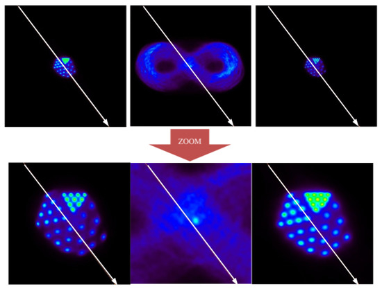 Sensors | Free Full-Text | Simulation Study of a Frame-Based Motion Correction Algorithm for ...