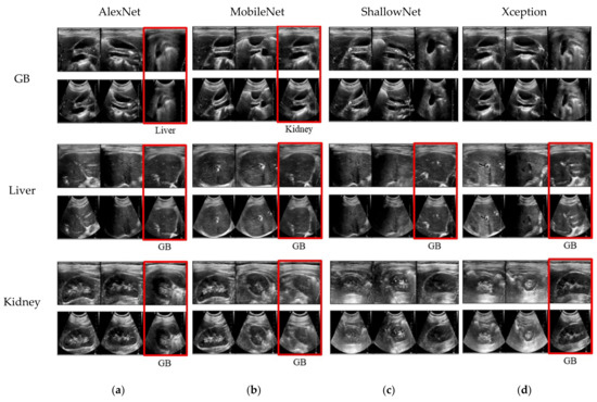 Reverse Scan Conversion and Efficient Deep Learning Network Architecture for Ultrasound Imaging ...