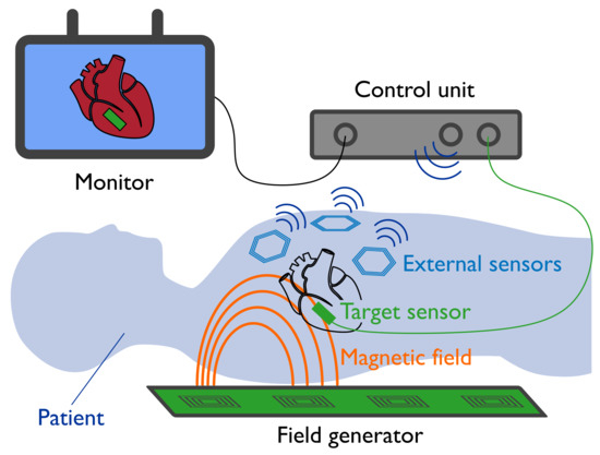 Planar Body-Mounted Sensors for Electromagnetic Tracking