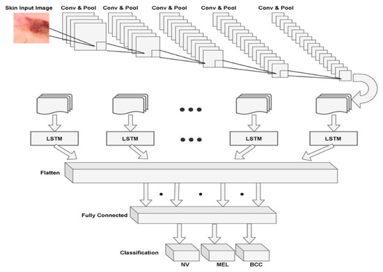 Sensors | Free Full-Text | Classification of Skin Disease Using Deep ...