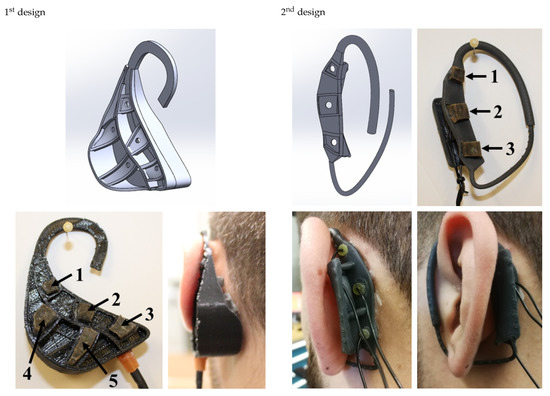 Custom-Fitted In- and Around-the-Ear Sensors for Unobtrusive and On-the ...