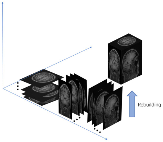 3D MRI Reconstruction Based on 2D Generative Adversarial Network Super ...