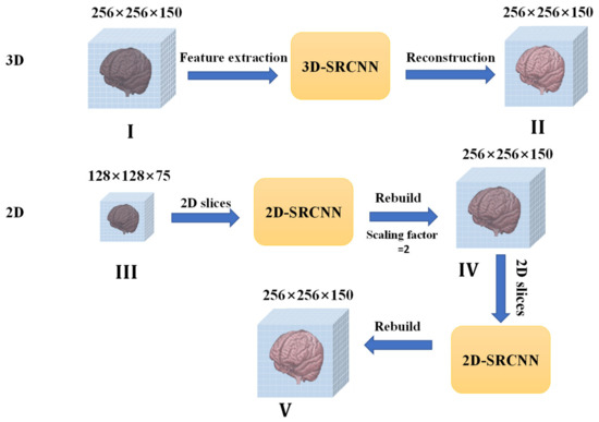 3D MRI Reconstruction Based on 2D Generative Adversarial Network Super ...