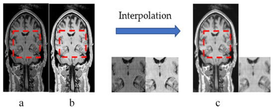 3D MRI Reconstruction Based on 2D Generative Adversarial Network Super ...