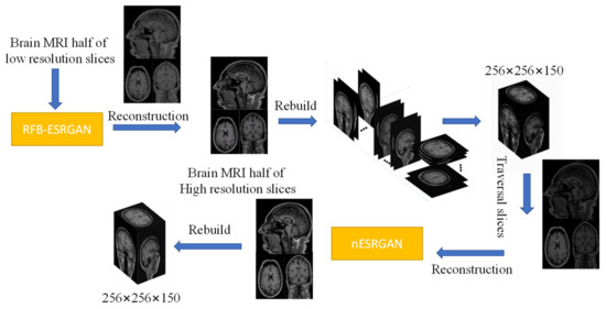 3D MRI Reconstruction Based on 2D Generative Adversarial Network Super ...