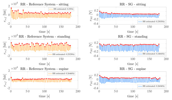 A Wearable System with Embedded Conductive Textiles and an IMU for ...