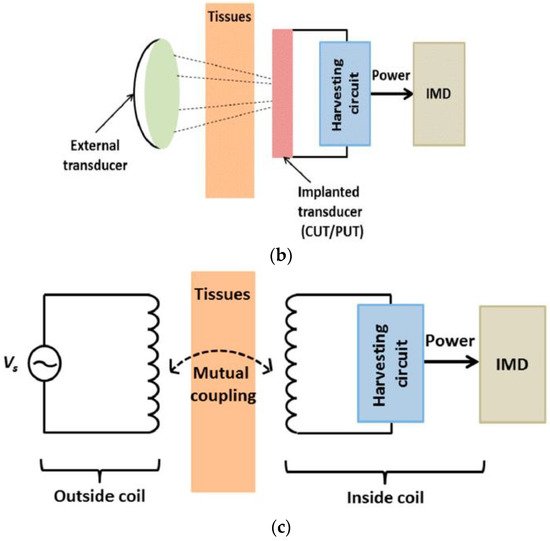 Review on Medical Implantable Antenna Technology and Imminent Research ...
