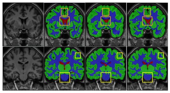 Learning U-Net Based Multi-Scale Features in Encoding-Decoding for MR Image Brain Tissue ...