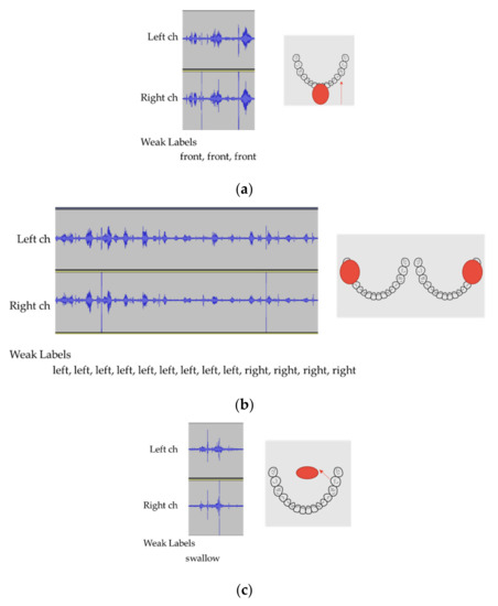 Automatic Detection of Chewing and Swallowing