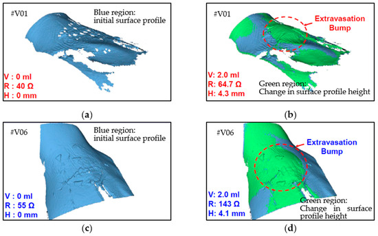 Novel Conformal Skin Patch with Embedded Thin-Film Electrodes for Early ...