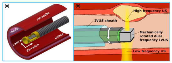 Recent Advances in Transducers for Intravascular Ultrasound (IVUS) Imaging