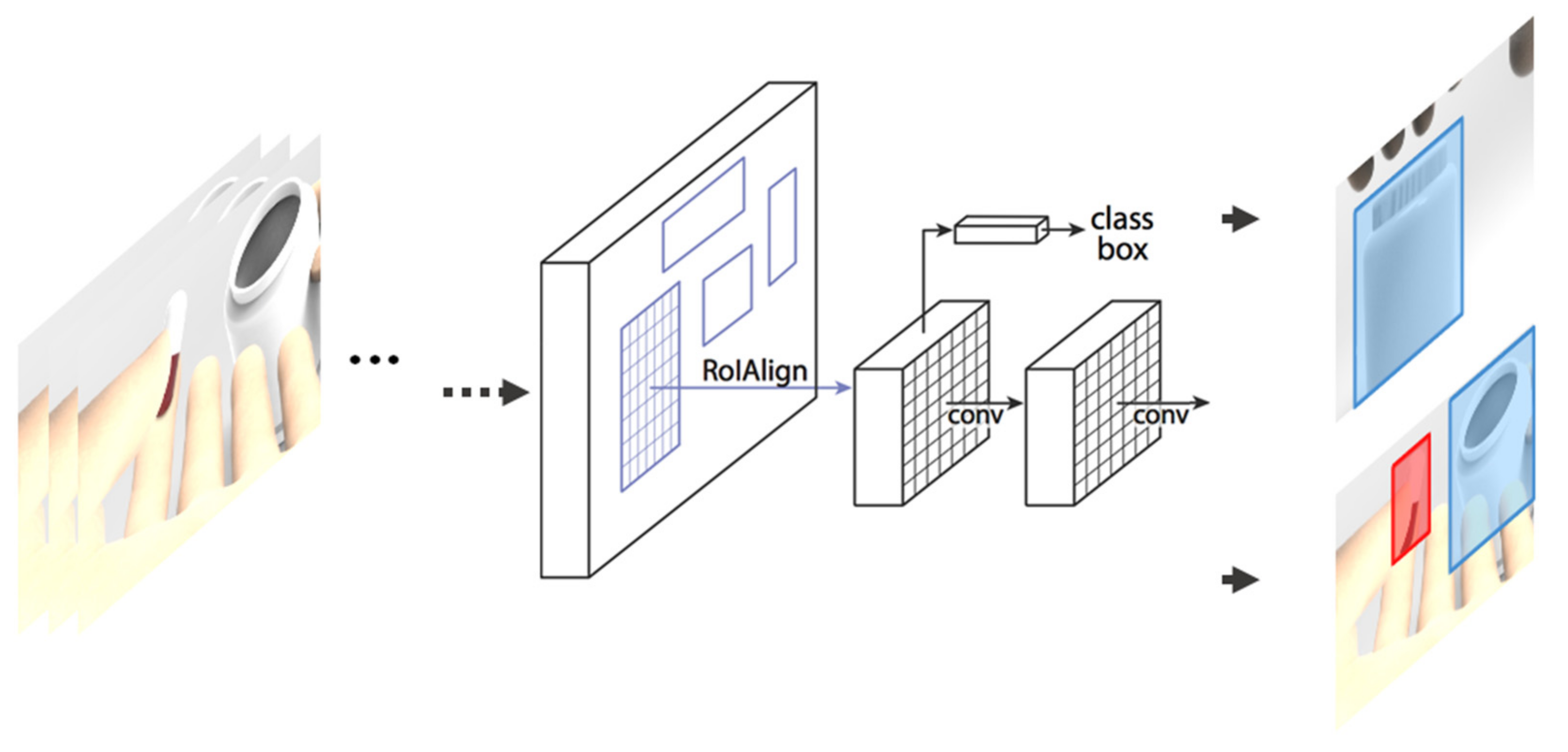 Sensors | Free Full-Text | Development of a Wearable Camera and AI ...