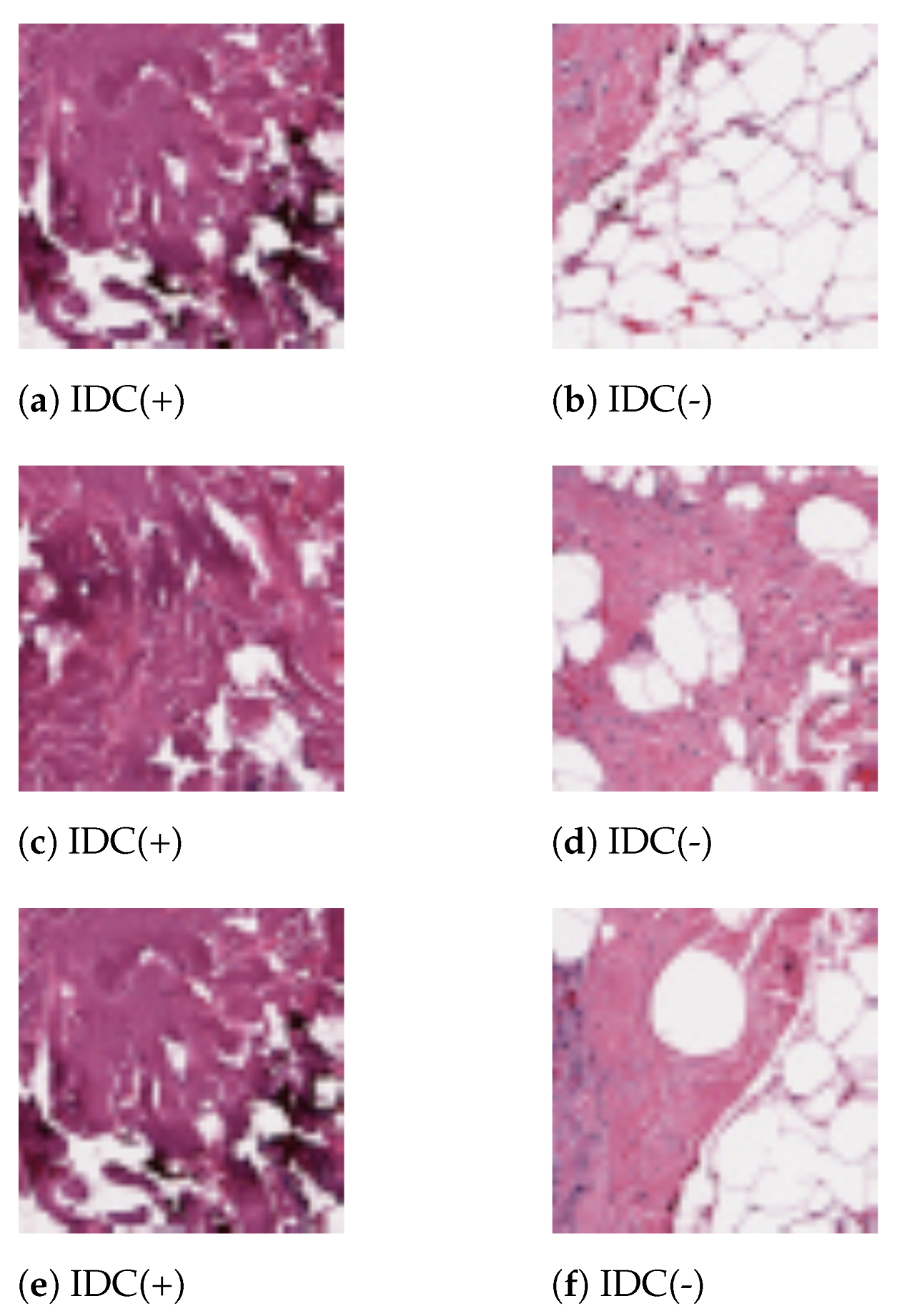 Computer Aided Breast Cancer Detection Using Ensembling of Texture and ...