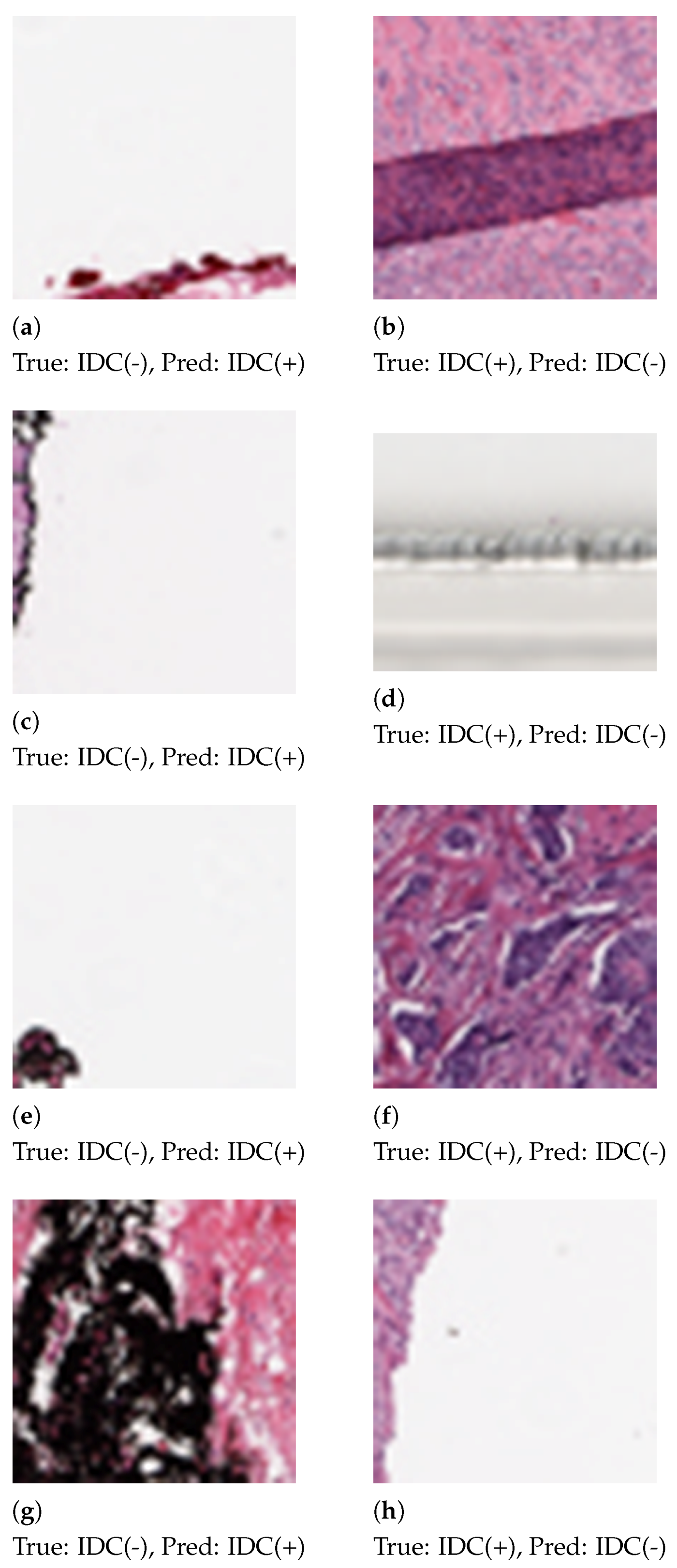 Computer Aided Breast Cancer Detection Using Ensembling of Texture and Statistical Image Features