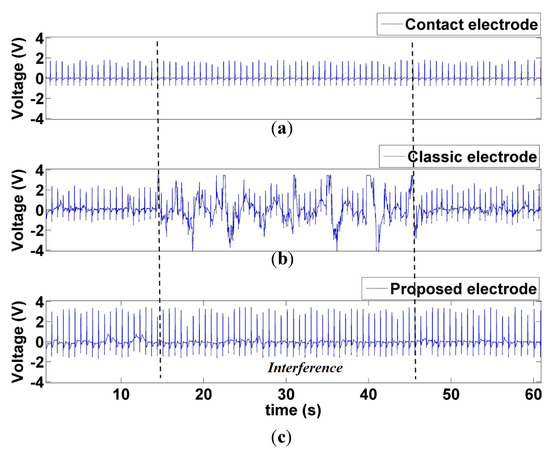 Novel Stable Capacitive Electrocardiogram Measurement System