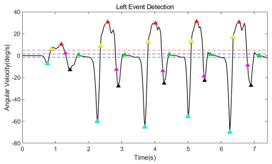 Asymmetric Gait Analysis Using a DTW Algorithm with Combined Gyroscope and Pressure Sensor