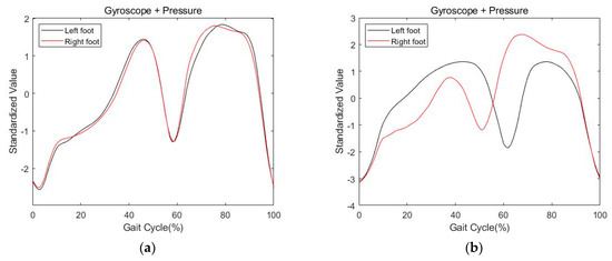 Asymmetric Gait Analysis Using a DTW Algorithm with Combined Gyroscope and Pressure Sensor