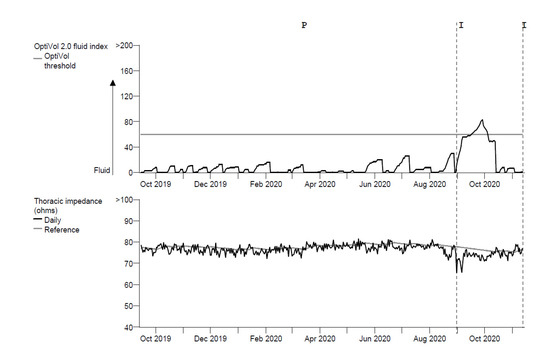 Remote Monitoring of Heart Failure in Patients with Implantable ...