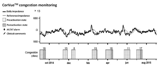 Remote Monitoring of Heart Failure in Patients with Implantable ...