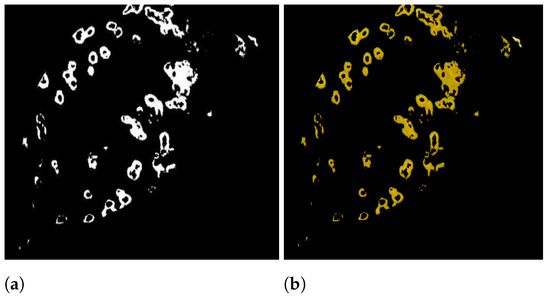 AI-Driven Framework for Recognition of Guava Plant Diseases through ...