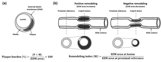 Mechanically Rotating Intravascular Ultrasound (IVUS) Transducer: A Review