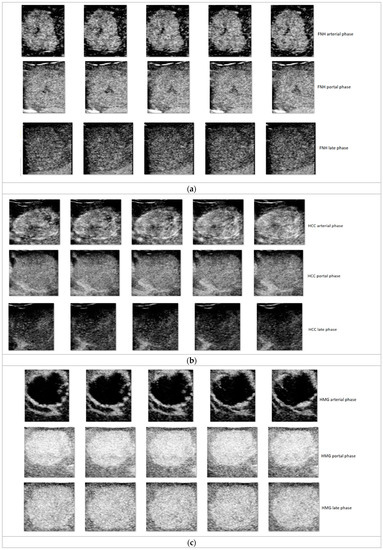 Deep Neural Architectures for Contrast Enhanced Ultrasound (CEUS) Focal ...