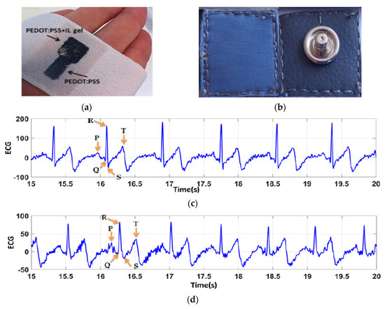 Wearable Smart Textiles for Long-Term Electrocardiography Monitoring—A ...