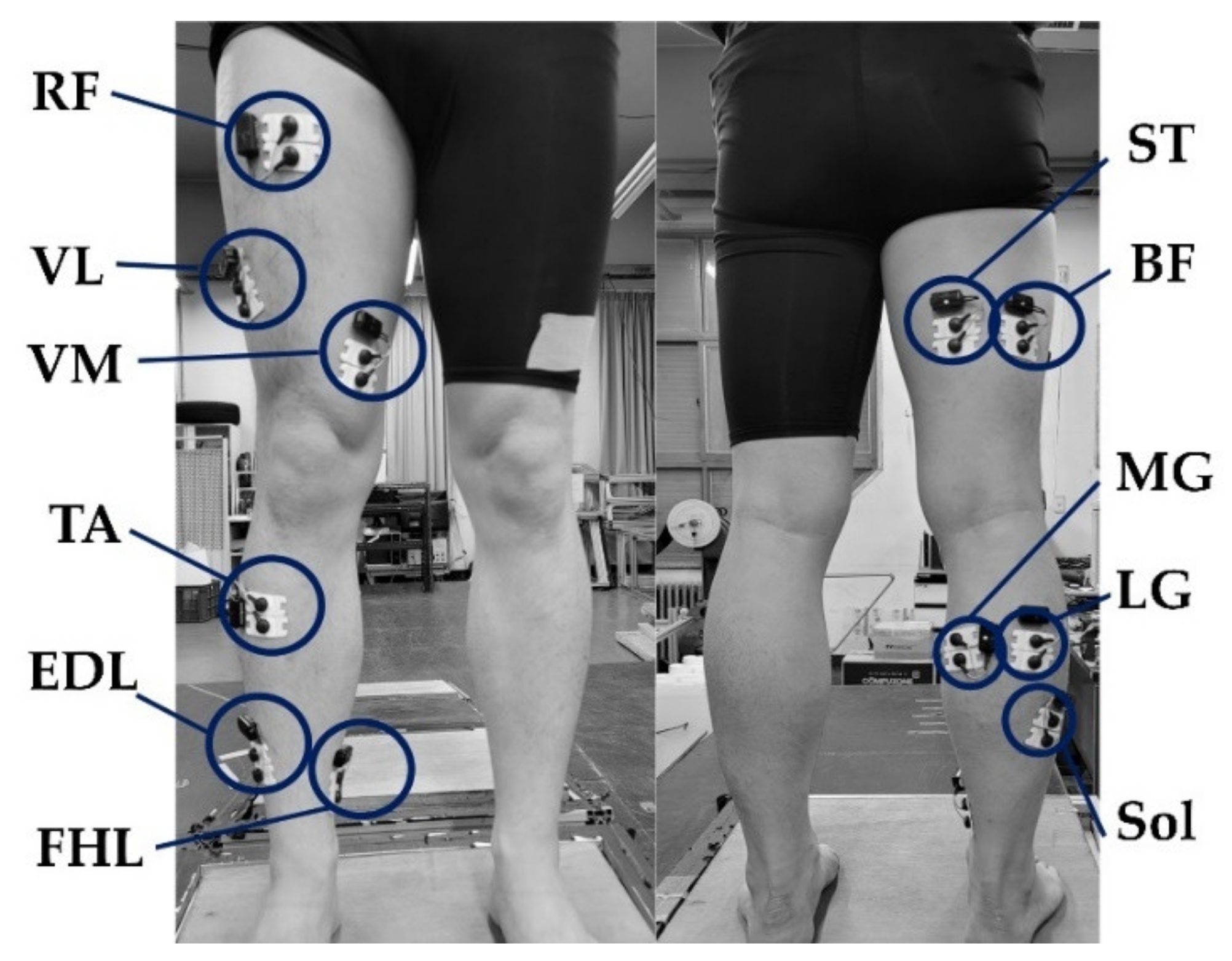 Classification of Walking Environments Using Deep Learning Approach ...