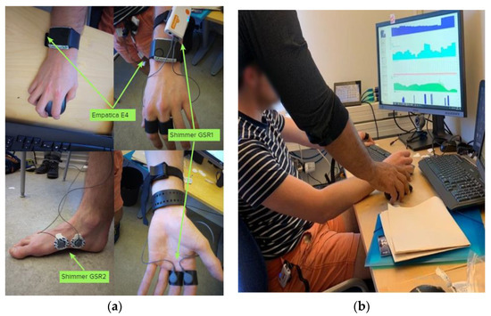 Correlation Analysis of Different Measurement Places of Galvanic Skin ...