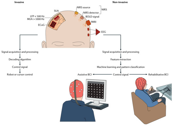 Sensors | Free Full-Text | Embedded Brain Computer Interface: State-of ...