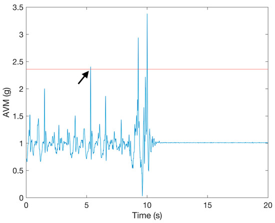 Sensors | Free Full-Text | Event-Centered Data Segmentation in Accelerometer-Based Fall ...