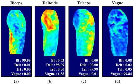 Detection of Muscle Activation during Resistance Training Using ...