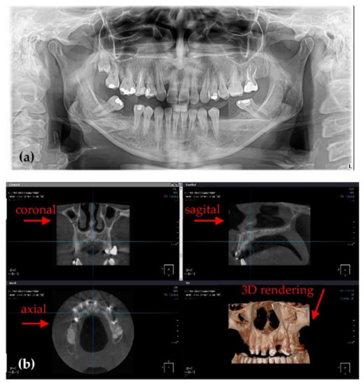 Optimization of X-ray Investigations in Dentistry Using Optical ...