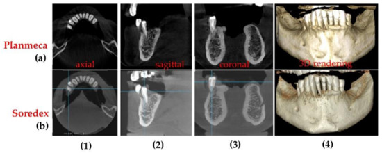 Optimization of X-ray Investigations in Dentistry Using Optical ...