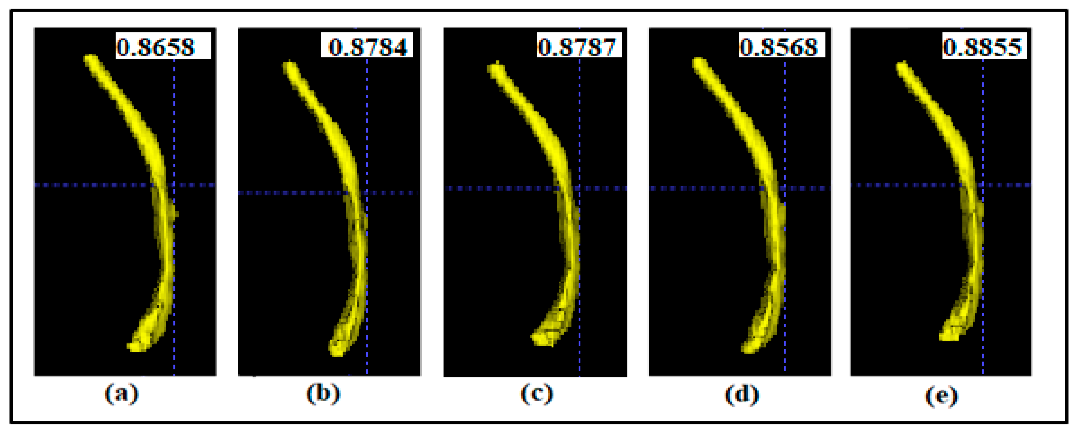Sensors | Free Full-Text | Esophagus Segmentation in CT Images via ...