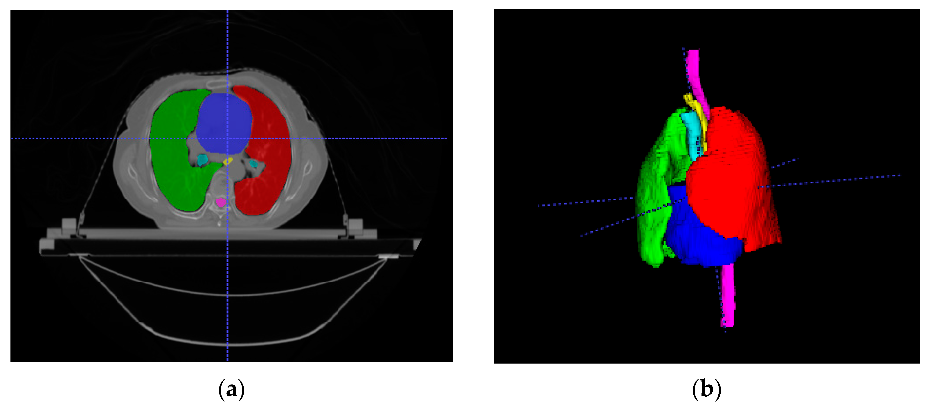Sensors | Free Full-Text | Esophagus Segmentation in CT Images via ...