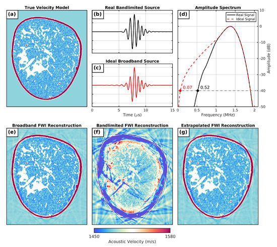 Deep-Learning-Driven Full-Waveform Inversion for Ultrasound Breast Imaging
