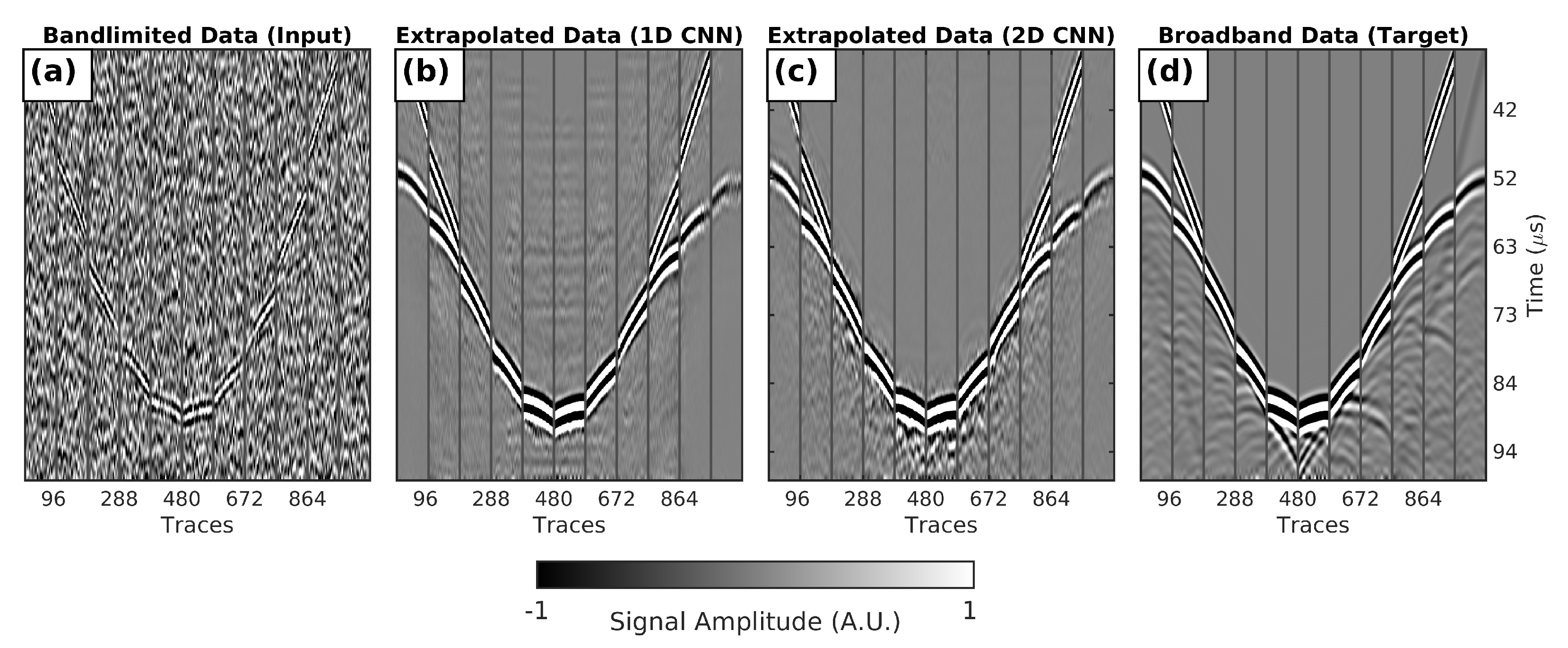 Deep-Learning-Driven Full-Waveform Inversion for Ultrasound Breast Imaging