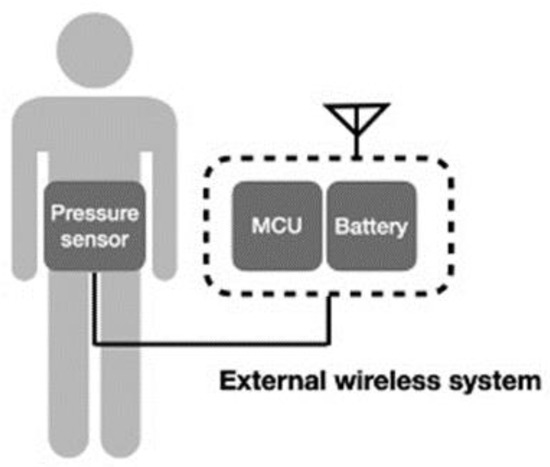 Systematic Review of Diagnostic Sensors for Intra-Abdominal Pressure ...