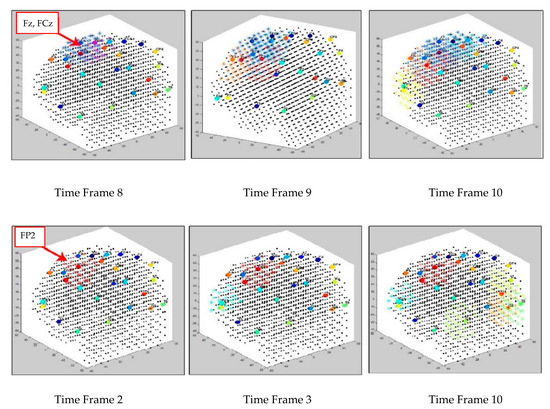 Sensors | Free Full-Text | Deep Learning of Explainable EEG Patterns as Dynamic Spatiotemporal ...