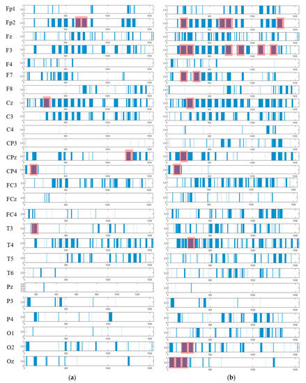 Sensors | Free Full-Text | Deep Learning of Explainable EEG Patterns as Dynamic Spatiotemporal ...