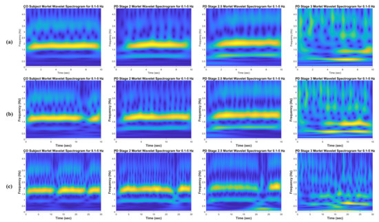 Implementation of a Deep Learning Algorithm Based on Vertical Ground ...