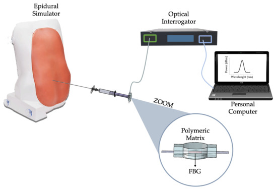 Soft System Based on Fiber Bragg Grating Sensor for Loss of Resistance Detection during Epidural ...