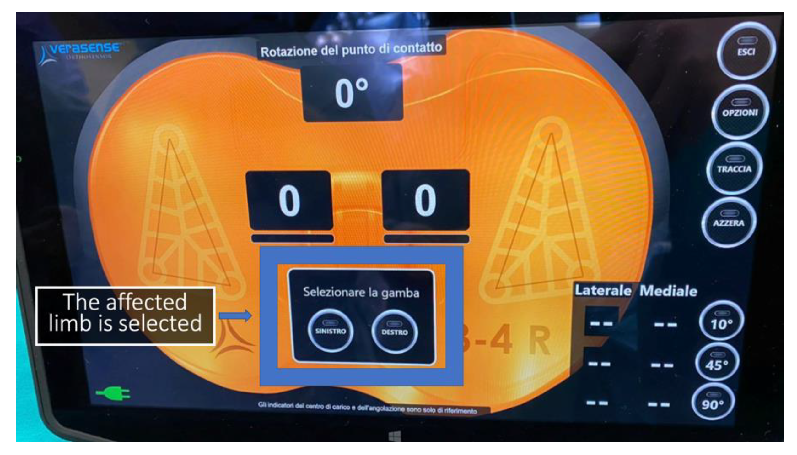 Kinetic Sensors for Ligament Balance and Kinematic Evaluation in ...